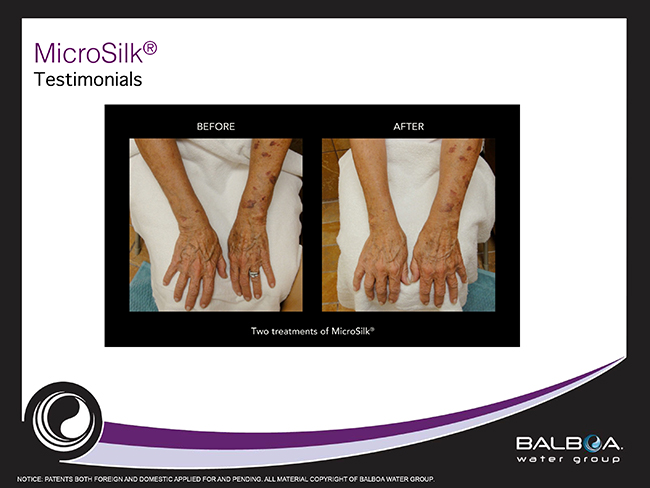 Microsilk - Health and Beauty | IQue Hottubs of Sweden